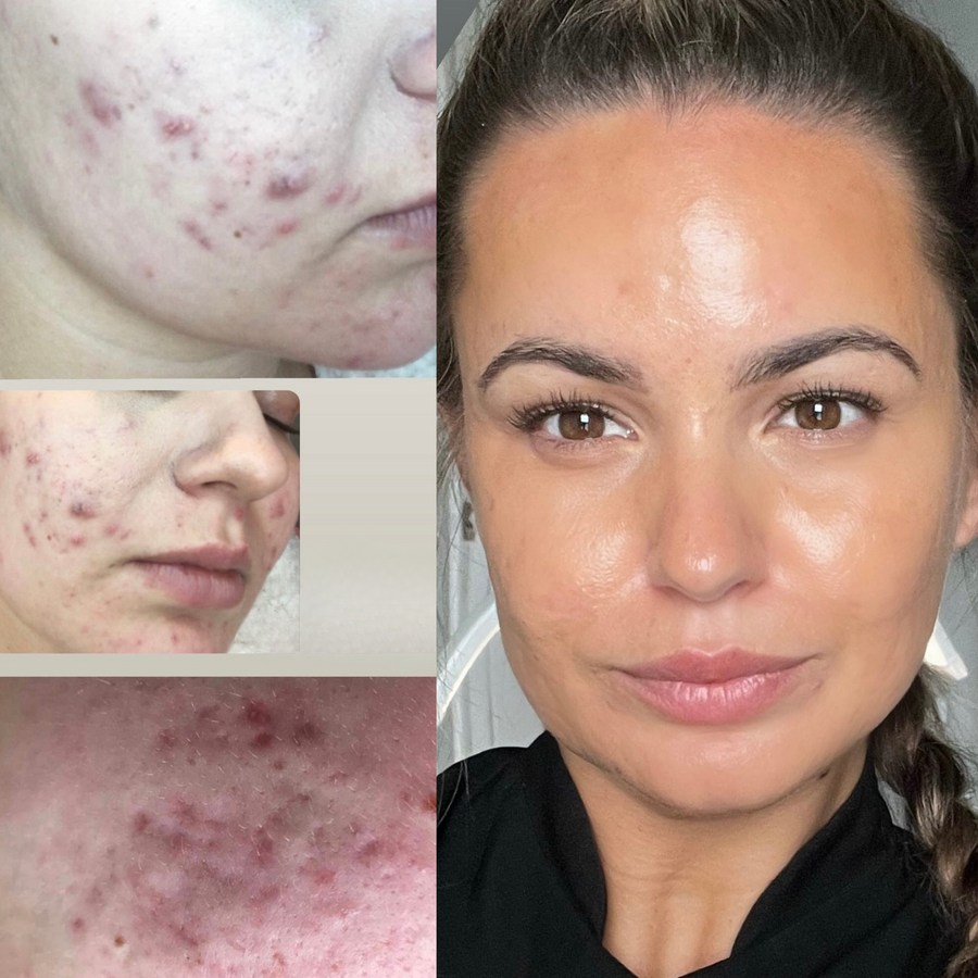 New for 2025 Dr. Pen M7S Next Generation Dermapen – Pure Derma London